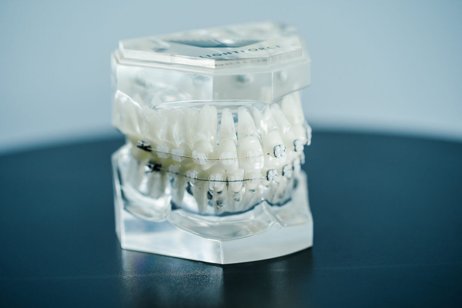 The Science Behind LightForce Braces - Noble Orthodontics